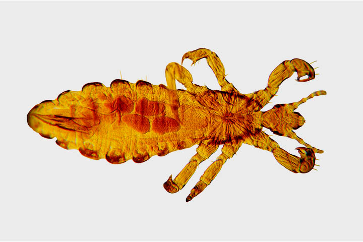 Lice Facts for Kids: Lice Pest Information for Students